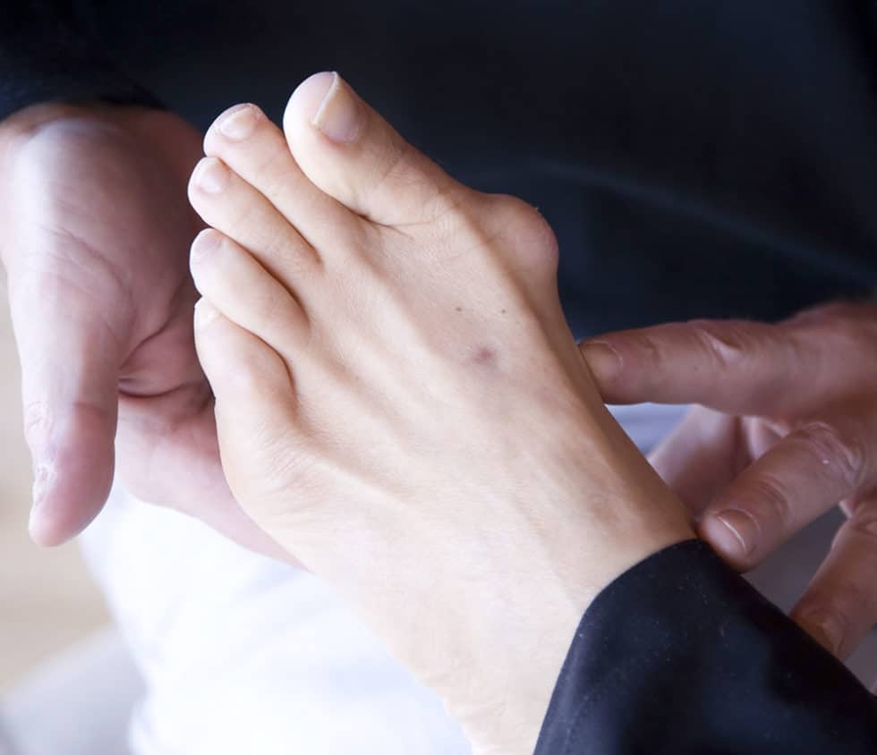 Toe Deformities // Midwest Podiatry Centers // Toe Deformities ...