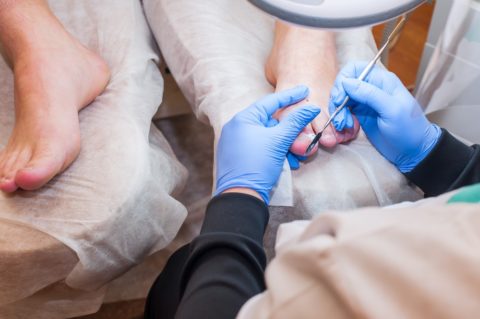 Does Ingrown Toenail Surgery Hurt? // Midwest Podiatry Centers