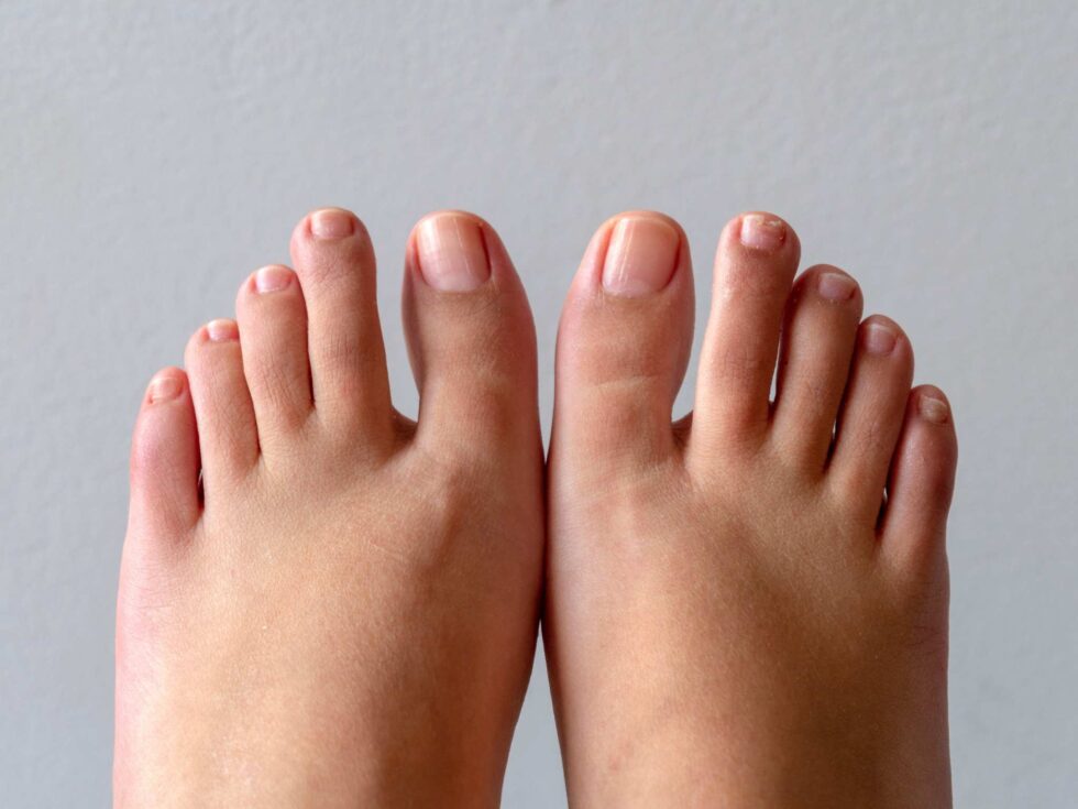 Ingrown Toenails Treatment // Midwest Podiatry Centers